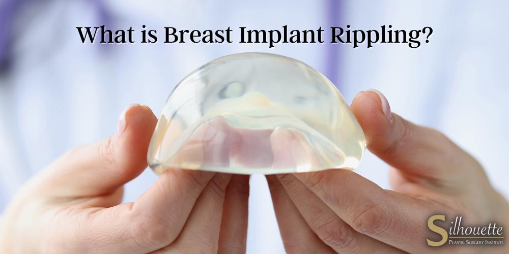 Breast Implant Rippling | Silhouette Plastic Surgery