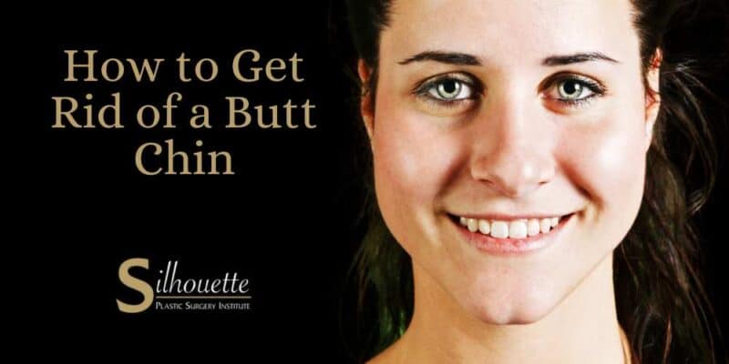 How to Get Rid of a Butt Chin or Cleft Chin in Bakersfield, CA